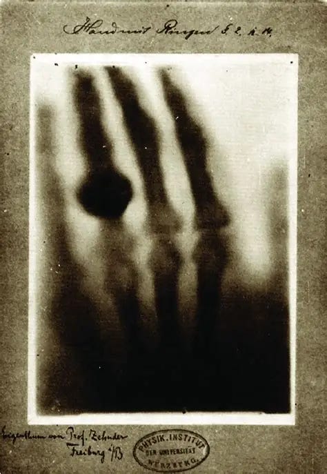 Did you know — the origin of X-Ray | by Rebecca Trocki | Nov, 2025 | Medium