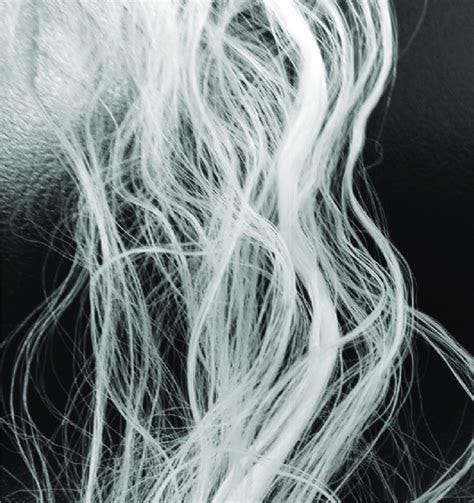 What are the uses of Cellulose acetate/PLA for nerve injury? - Xrporx ...