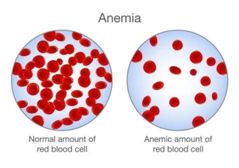 How do I know if I’m anemic?. Anemia is a very common clinical… | by ...