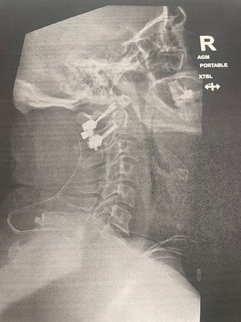 Leading with Focus Through Agility: Lessons from a Broken Neck | by ...