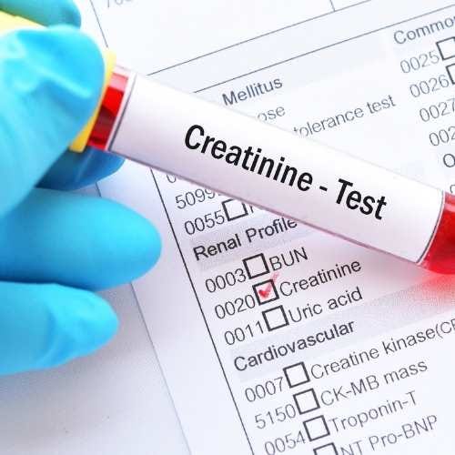 What’s creatinine with a kidney test in blood? | by Medasia.Store | Medium