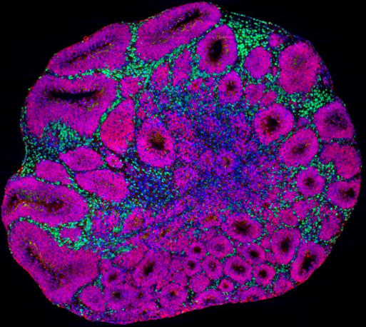 Orgainoids. (Human Brain Organoid Culture) | by International Youth ...