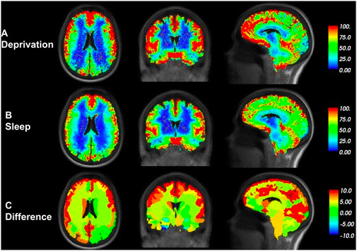 Sleep, cognitive performance, and academic performance: a review on ...