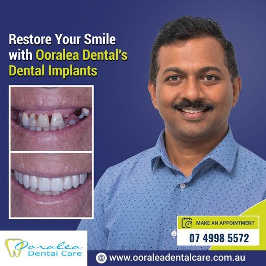 Restore Your Smile with Ooralea Dental’s Dental Implants | by ...