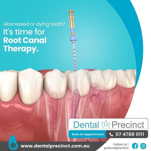 Abscessed or Dying Tooth? It’s Time For Root Canal Therapy — Dental ...
