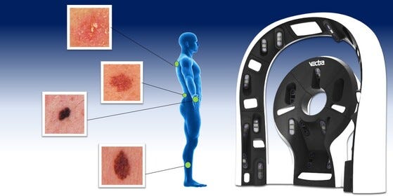 Skin Cancer Detection using Convolutional Neural Networks and Gradient ...