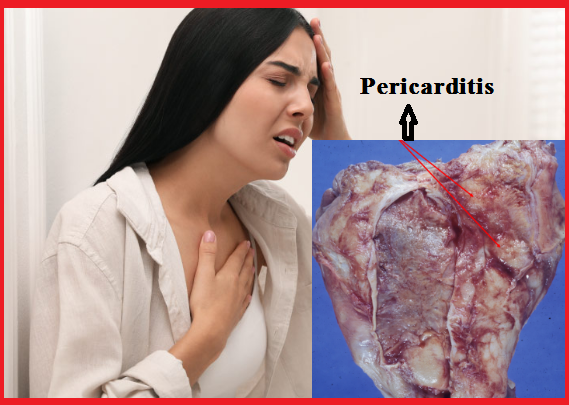 How to know Symptoms of Pericarditis? What are the main effects and ...