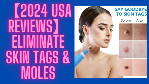 Full Body Skin Tag Remover Fast Action Solution “No Scam” | by Full ...