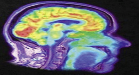 A Beginner’s Guide to Brain Analysis (Part 2) | by Peace Ishola | Medium