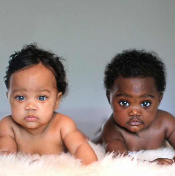 10 Rarest Black Twins Who Are One In A Million | by Black Culture ...