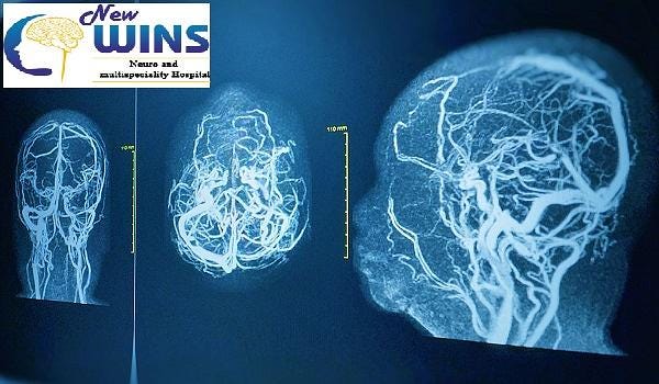 Why Brain Angiography Is Essential? | by New Wins Hospital | Jul, 2024 ...