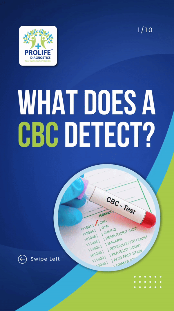 Decoding the Complete Blood Count (CBC) Test: What it Reveals - PROLIFE ...