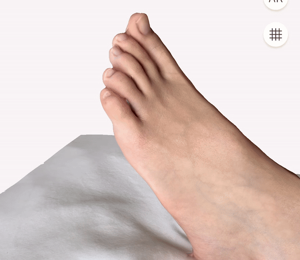 This is how I made a 3D-printed plaster cast alternative for my wife ...
