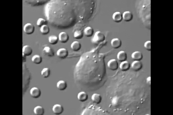 Penn Researchers Engineer Macrophages to Engulf Cancer Cells in Solid ...