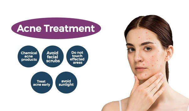 Acne Treatment Which Genuinely Works — Acne tips for teenagers | by ...