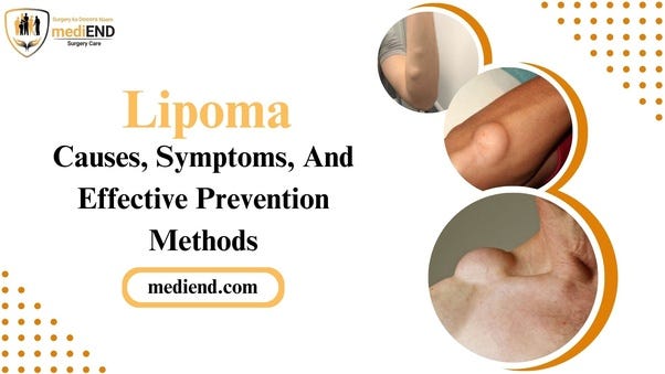 Lipoma Causes, Symptoms, And Effective Prevention Methods | by Mediend ...