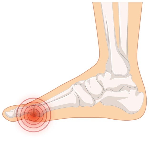 How to Manage Foot Heel Spur Pain: Tips and Tricks for 2024 | by Boyner ...
