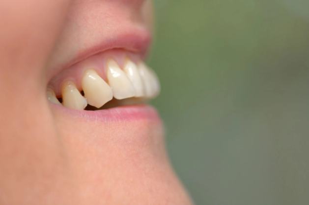 Why Healthy Gums are Important to Your Overall Health | by Lumoral | Medium