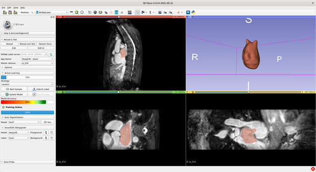 MONAI v0.6 and MONAI Label v0.1 Are Now Available — Monai Label Helps ...