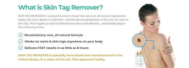 Clean as Teen Skin Tag Remover Serum Introduction, Reviews & Price ...