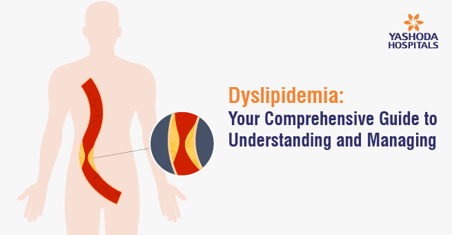 Demystifying Dyslipidemia: Causes, Symptoms, Diagnosis and Effective ...