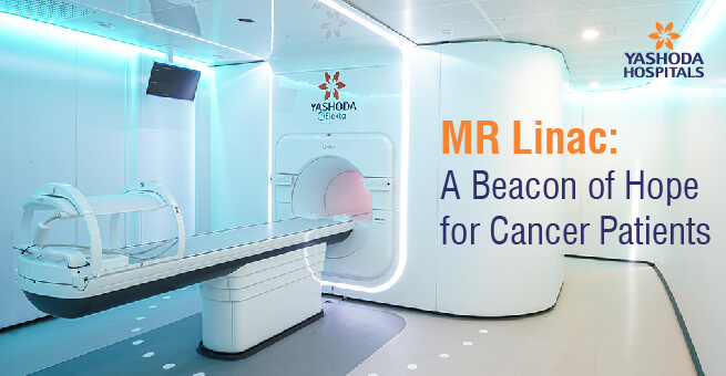 MR Linac: A Beacon of Hope for Cancer Patients - Yashoda ...