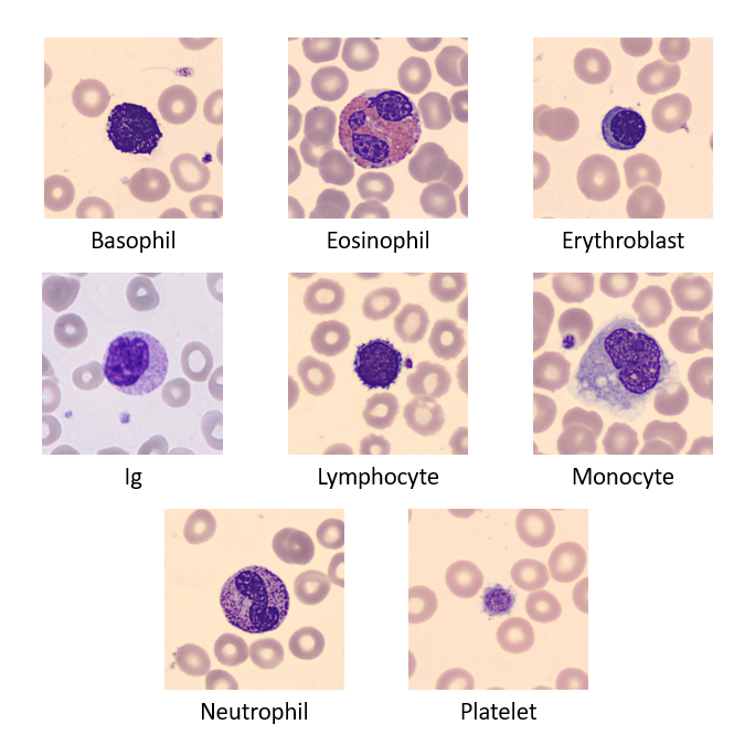 Classification peripheral blood cell | by Jorge Gonzalez S | Saturdays ...