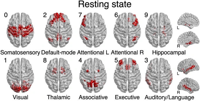 Modularity in ANNs and the brain. Written by Ashley Williams, Andero ...