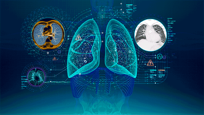 Artificial Intelligence is Going to Disrupt Healthcare — Here’s How | by Navya Riju | Medium