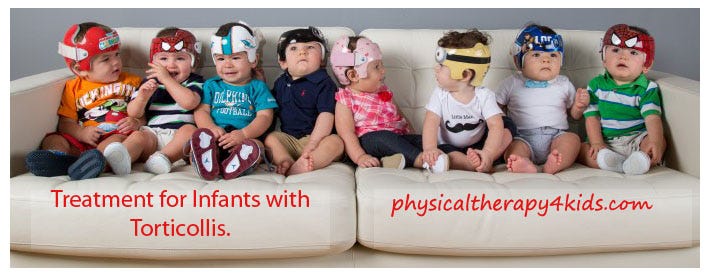 Torticollis aka Flat Head — Helmet | by Wendy Lager, PT – Owner ...