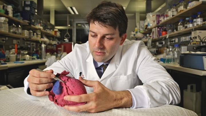 3D-printed heart models help doctors determine the size of the Watchman ...