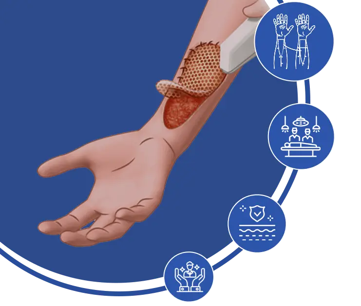 Skin Grafting Procedures at KBK Multi Speciality Hospitals | by KBK ...