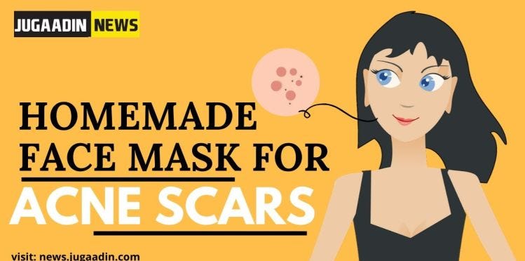8 HOMEMADE MASKS TO GET RID OF ACNE SCARS | by sanyam goel | Apr, 2024 ...