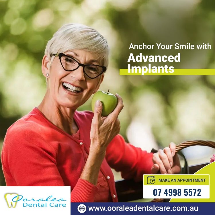 Anchor Your Smile with Advanced Implants — Dental Implants — Ooralea ...