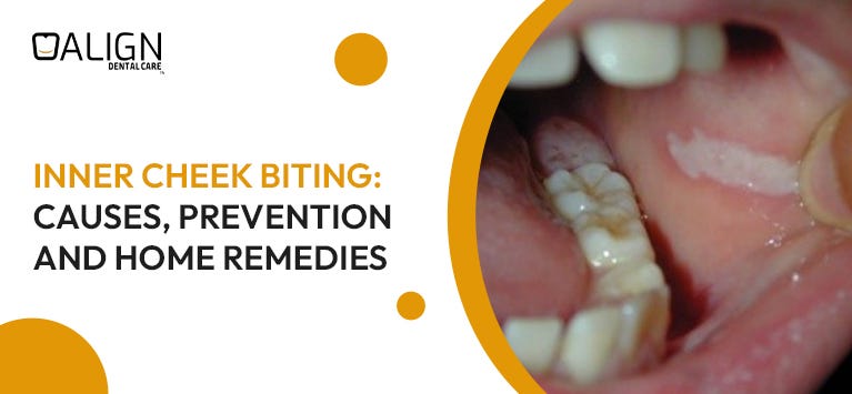 Inner Cheek Biting: Causes, Prevention and Home Remedies | by Align ...