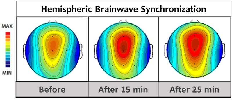 The Science of Brainwave Entrainment | by Narbis | Age of Awareness ...