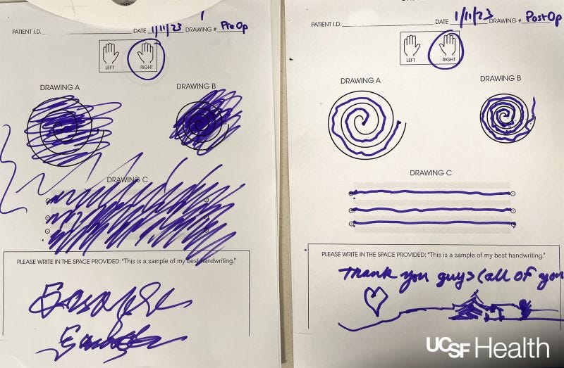 Finding Stability: Understanding and Managing Essential Tremor | by ...