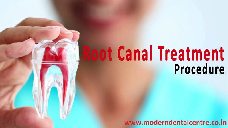 What is Root Canal Treatment Procedure? Step By Step Guide on Procedures to Follow | by Modern ...