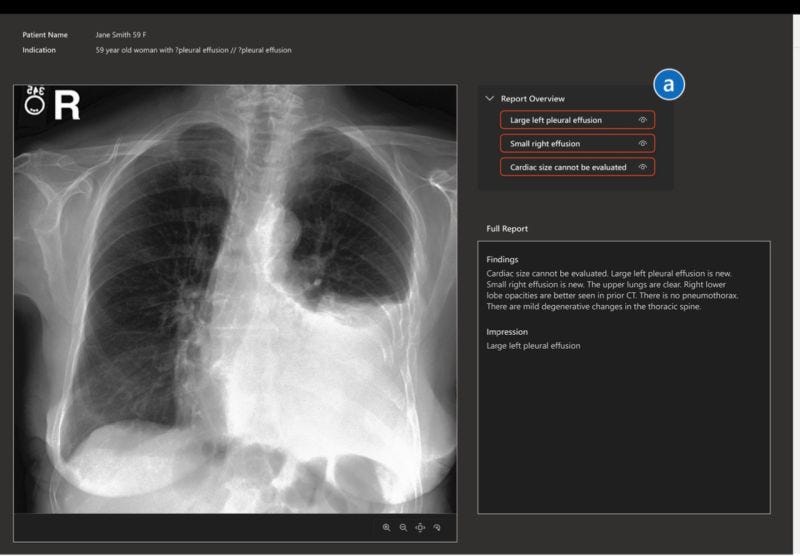 Vision-Language Models: The Disruptive Force Set to Redefine Radiology ...