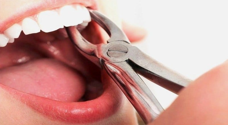 Finding the Best Dentist Near Bhosari, Pune: Pathak Dental Clinic | by Pathak Dental Clinic ...