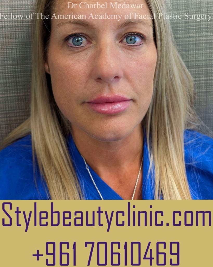 Dr Charbel Medawar New Lip Filler Technique at Style Beauty Clinic | by Dr Charbel Medawar ...