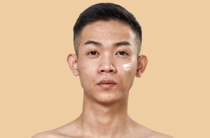 Top 5 most effective ingredients! for oily acne-prone skin. | by Akash Rai | Medium