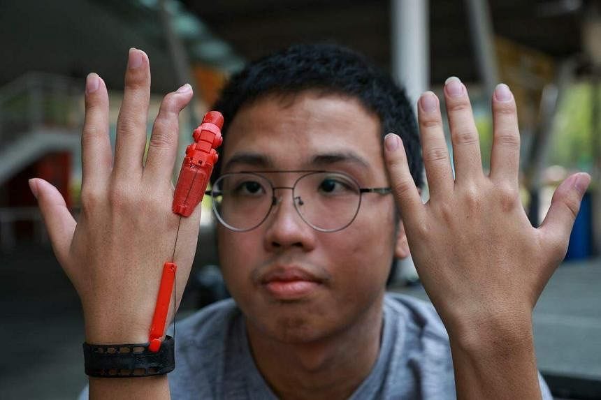 Reclaiming Dexterity: Exploring the World of Prosthetics for Fingers ...