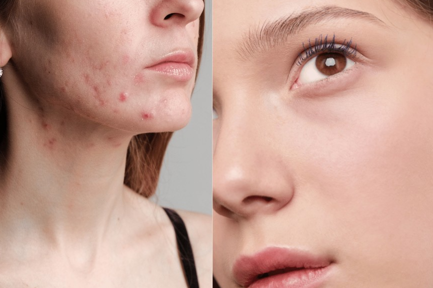 Ocean Envy Skin Tag Remover Price, Benefits, Order Now! | by Ocean Envy ...