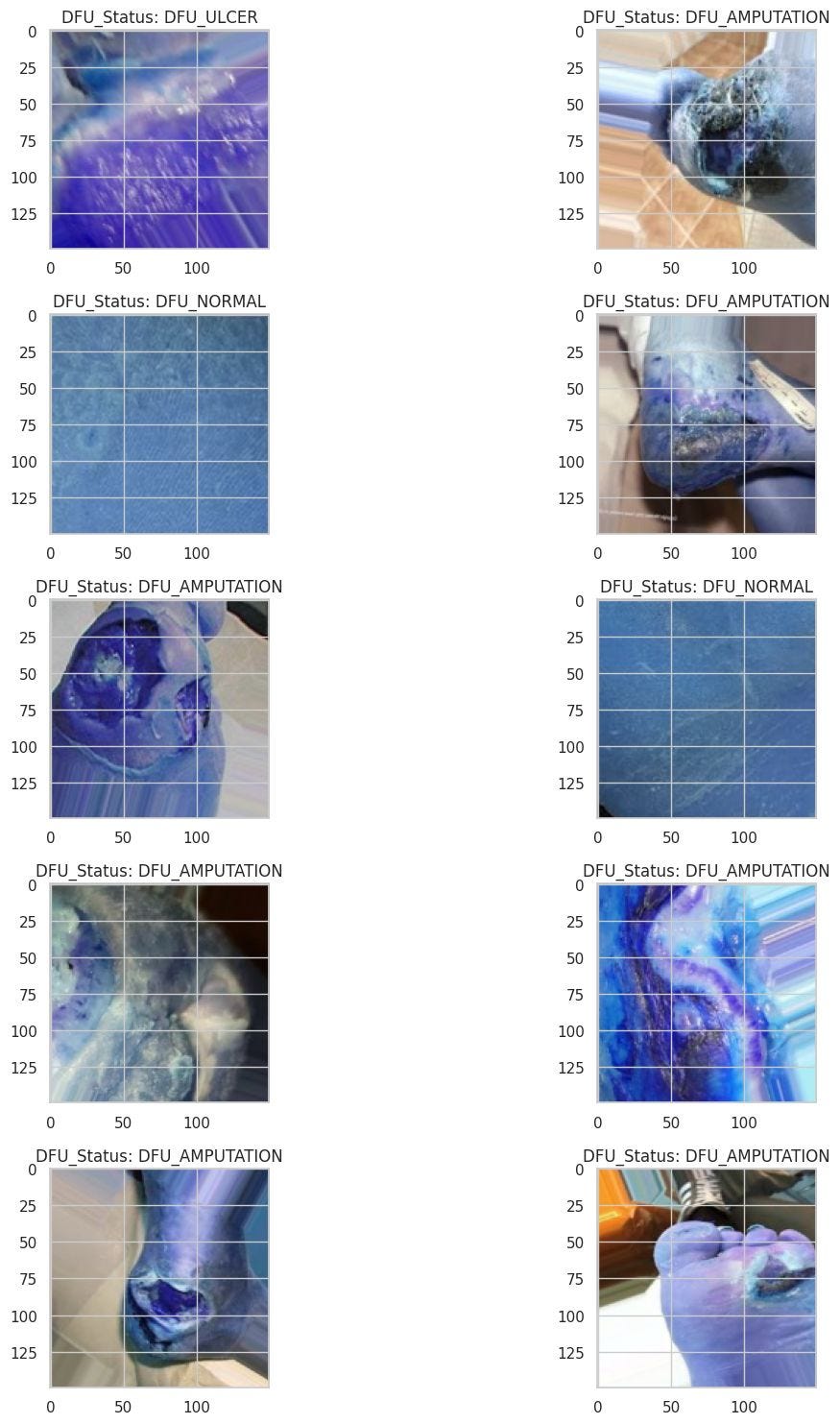 Detecting Diabetic Foot Ulcers Using Deep Learning: A Step Towards ...