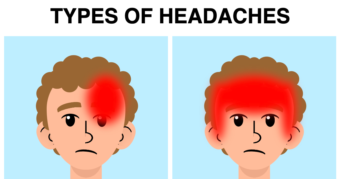 Types of Headaches - comi_CSS - Medium