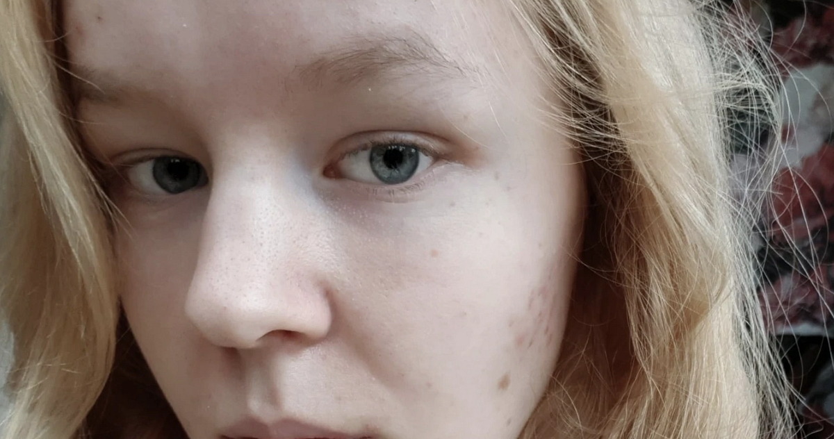 Her Story Isn’t About Euthanasia. It’s About Failing Mental-Health ...