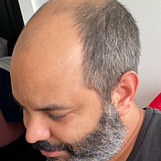 David Barbarin – Medium