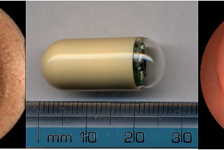 Anomaly Detection in Capsule Endoscopy Images: Feature selection and ...