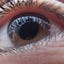 Spherical equivalent. A Spherical Equivalent is an estimate… | by ...